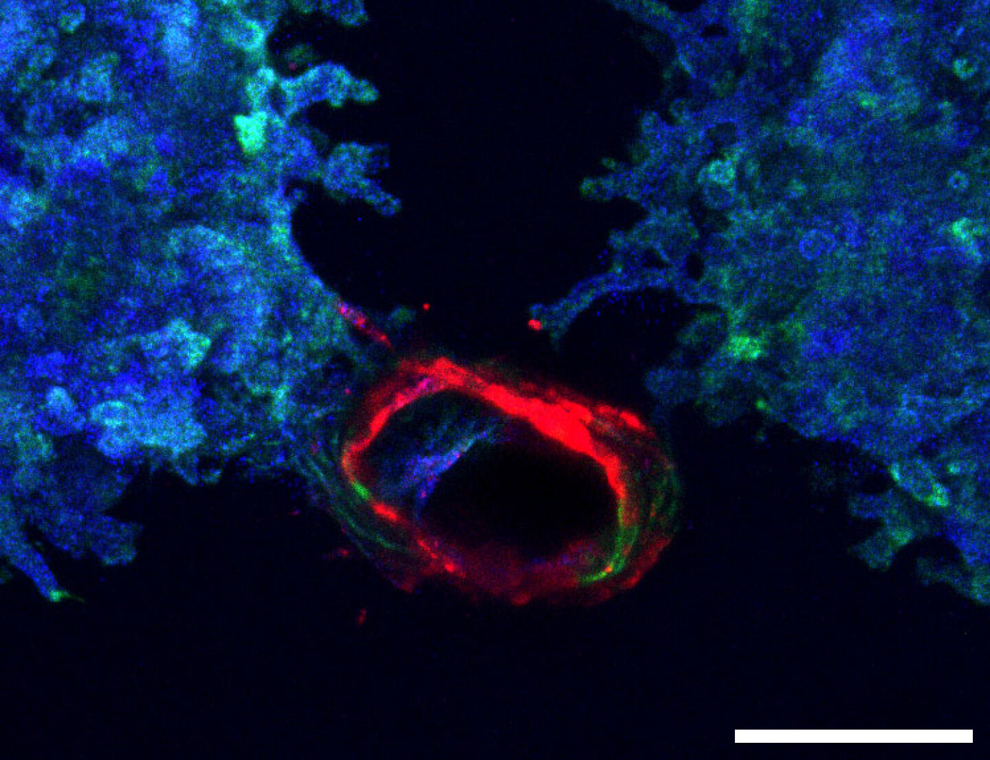 Toward Engineering a Human Kidney Collecting-Duct System | Regenerative ...